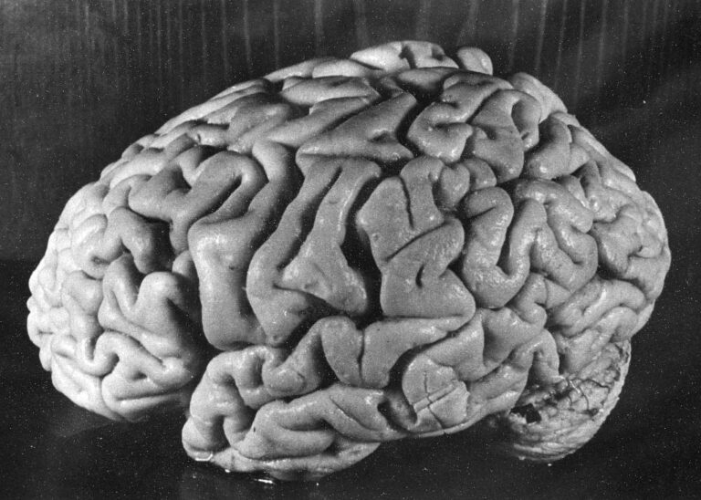 Einstein Museum of Science — Einstein’s Brain: “Mind of a Genius”